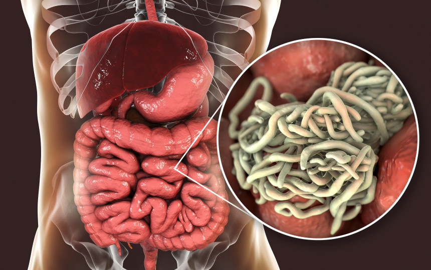 5 požymiai, galintys reikšti, kad jumyse gyvena parazitai | Moteris.lt